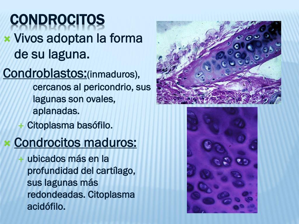 Diferencia entre condrocitos y osteocitos - PEDIAEXPERTOS