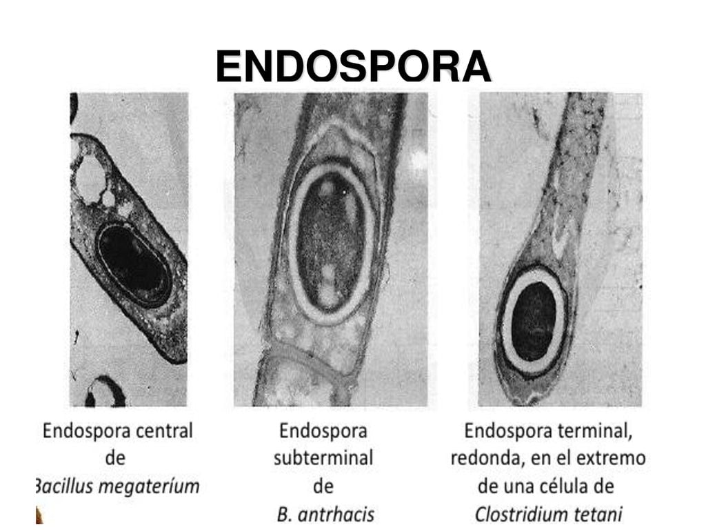 Diferencia entre espora y endospora - PEDIAEXPERTOS