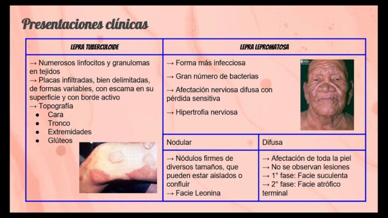 Diferencia entre la lepra tuberculoide y la lepromatosa - PEDIAEXPERTOS