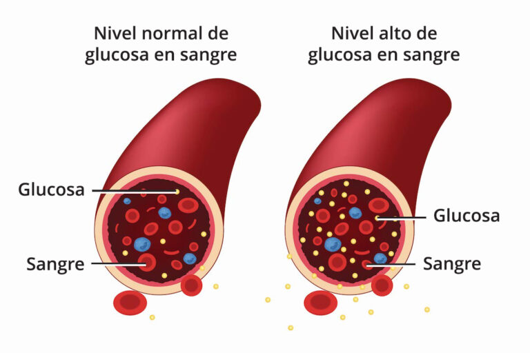 Diferencia entre el azúcar en sangre y la glucosa - PEDIAEXPERTOS